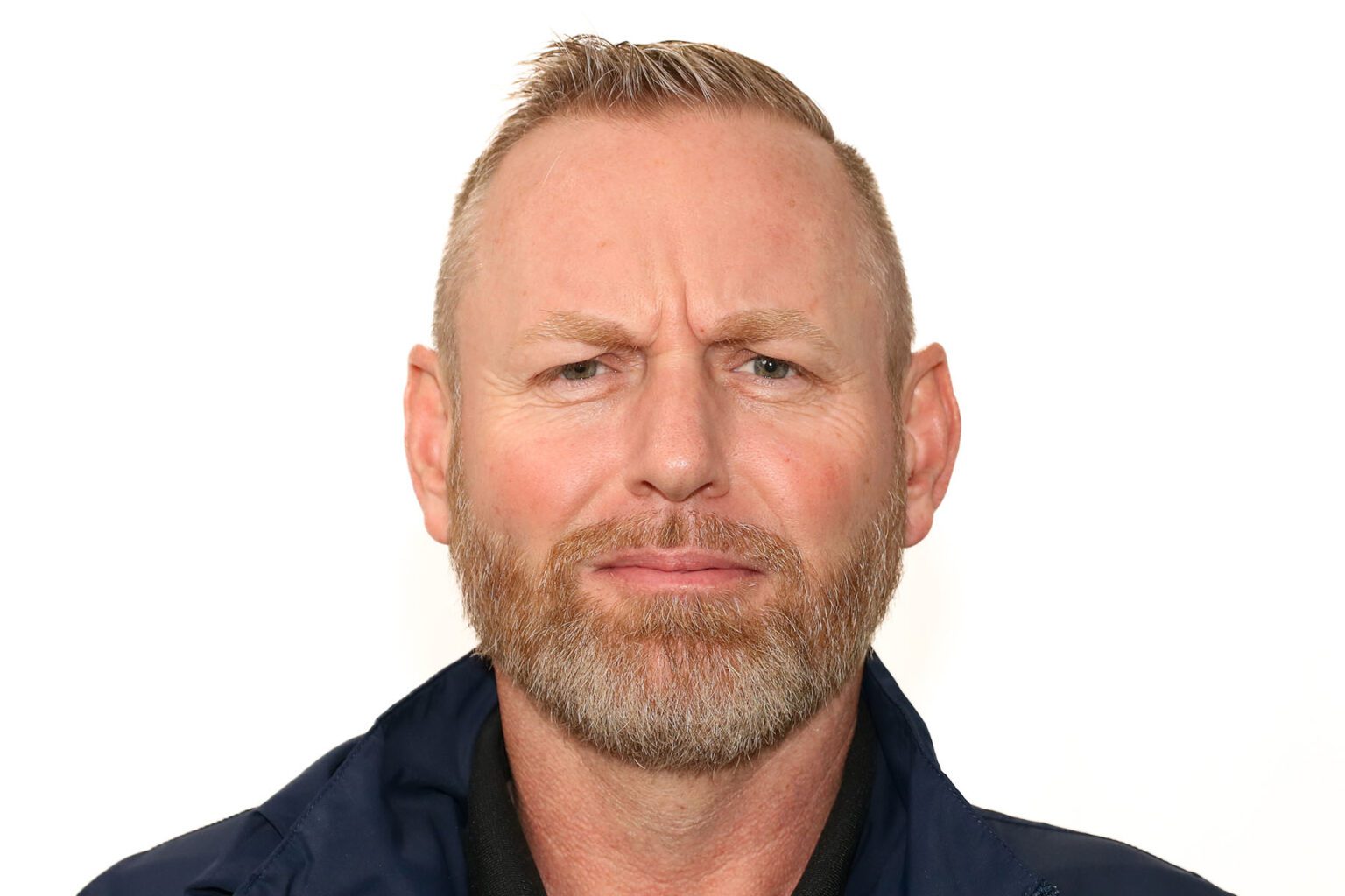 A Guide to Botox Dosing and What to Expect - bŏdze